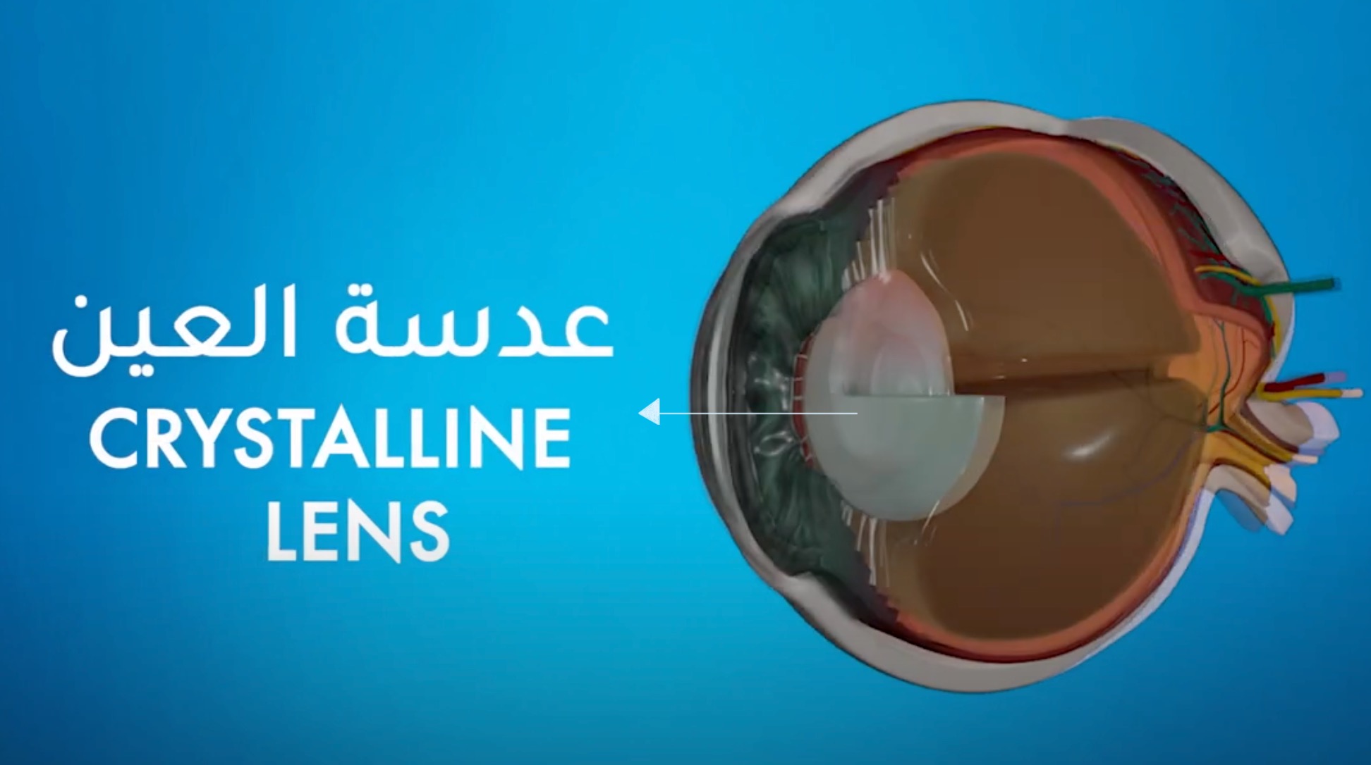 What Are Cataracts?