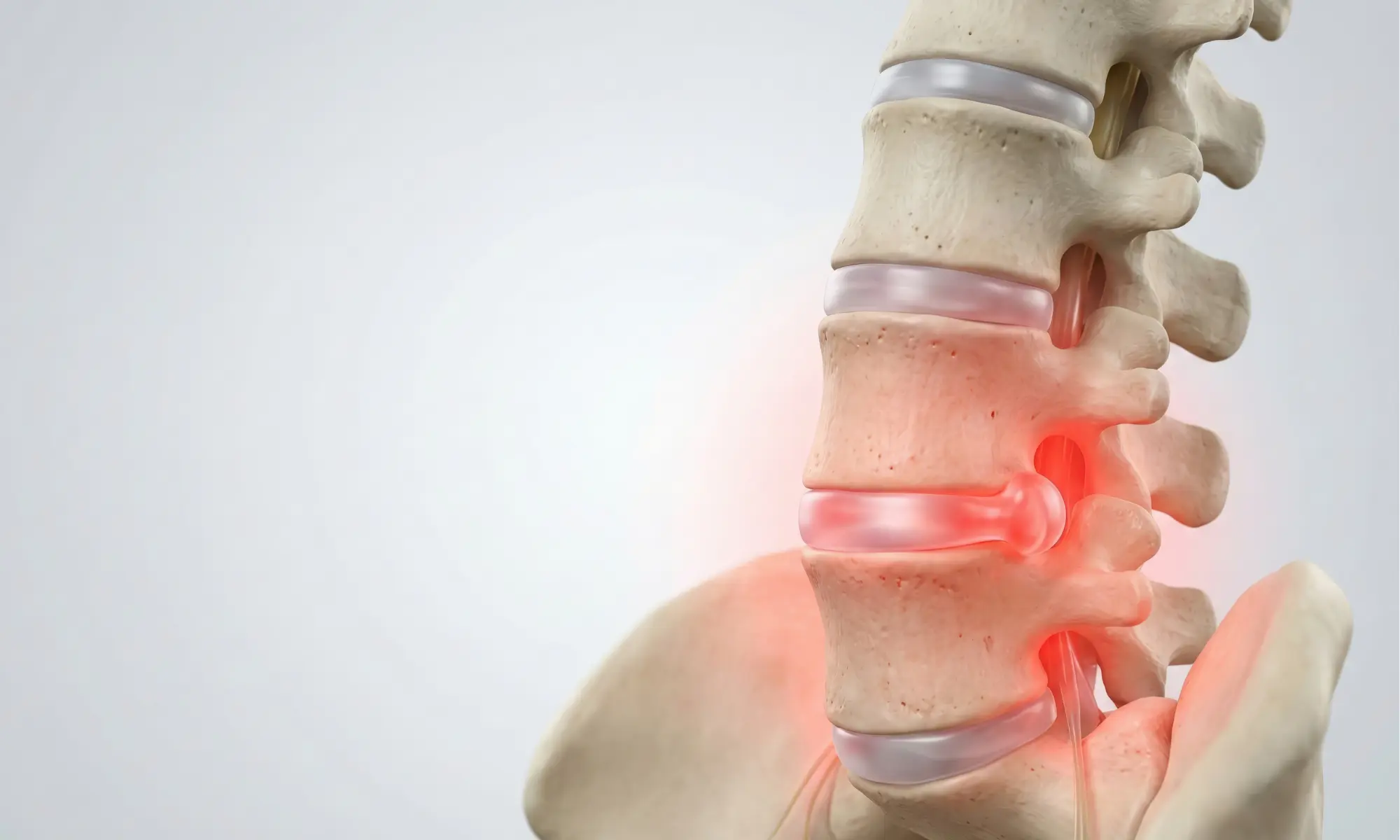 Herniated Disc Explained: From Symptoms to Treatment